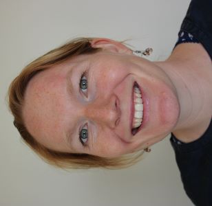 Neurofibroom – Oorzaken, Symptomen & Behandeling - Dermatology2Go